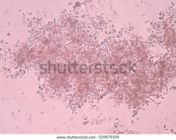 Amorphous Urine Sample Fine Microscope Stock Photo 329879309 | Shutterstock