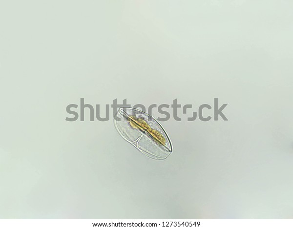 Amphora Sp Algae Under Microscopic View Stock Photo 1273540549 ...