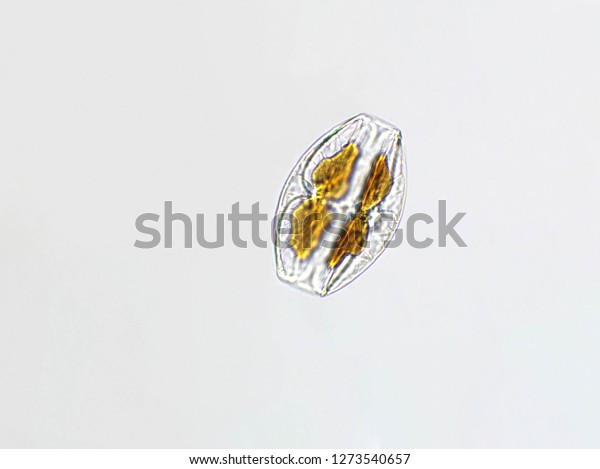 Amphora Sp Algae Under Microscopic View Stock Photo 1273540657 ...
