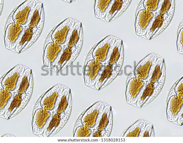 Amphora Sp Algae Under Microscopic View Stock Photo 1318028153 ...