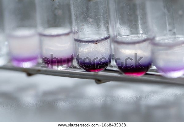 Analysis Starch Study Chemical Composition Laboratory Stock Photo ...