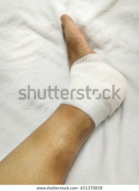 Ankle Man Paining Stock Photo 651370858 | Shutterstock