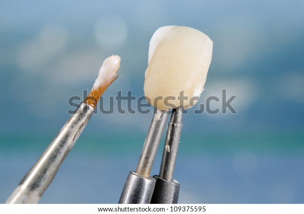 Applying Ceramic Material On Crown Dental Stock Photo (Edit Now) 109375595