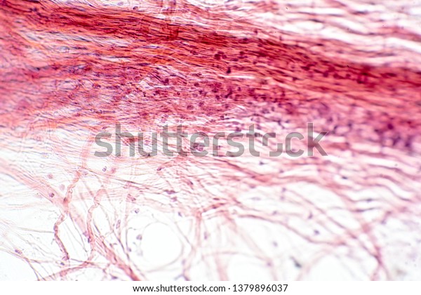 Areolar Connective Tissue Under Microscope View Stock Photo 1379896037 ...