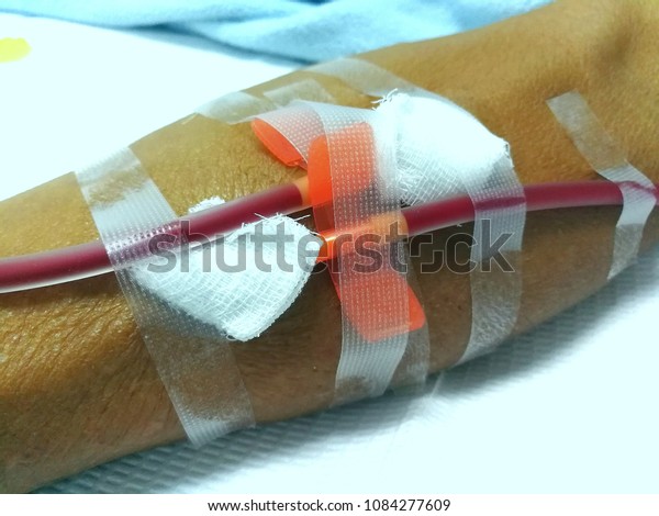 Arm Under Dialysis Process Stock Photo 1084277609 | Shutterstock