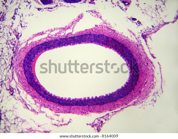 Artery Cross Section Stock Photo (Edit Now) 8164009