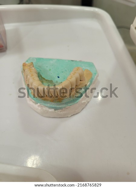 Artificial Tooth Making Mould Process Stock Photo 2168765829 | Shutterstock