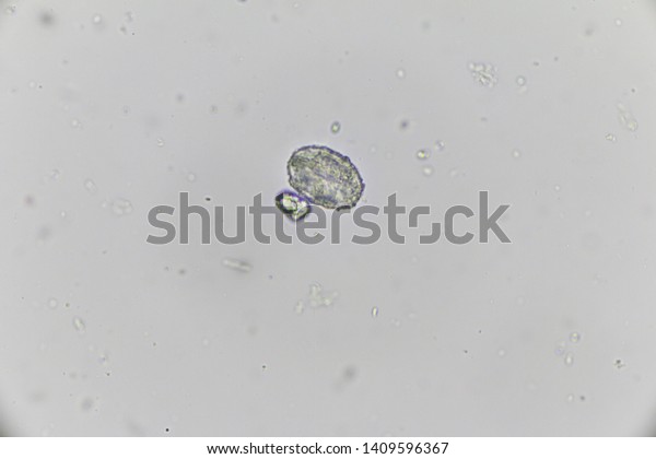 Ascaris Lumbricoides Egg Under Microscope Foto stock 1409596367 ...