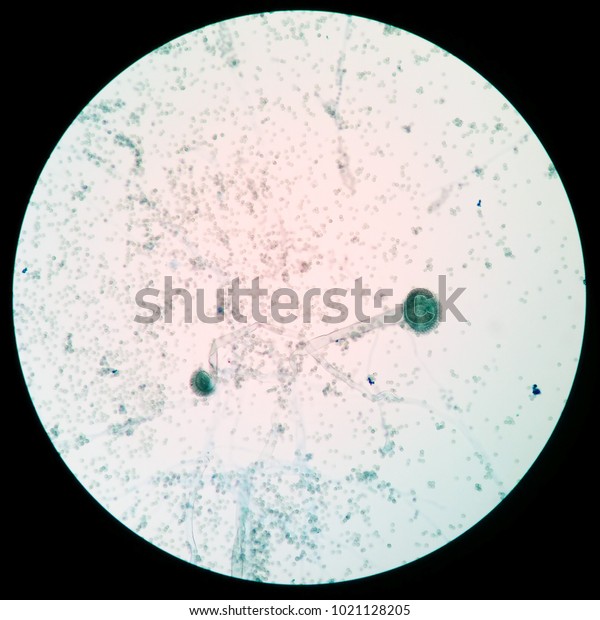 Aspergillus Flavus Under Microscope Stock Photo (Edit Now) 1021128205