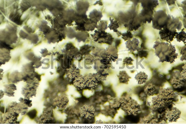 Aspergillus Mold Under Stereo Microscope View Foto de stock 702595450 ...