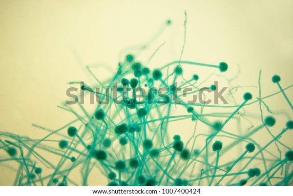 Aspergillus Under Microscope Stock Photo (Edit Now) 1007400424