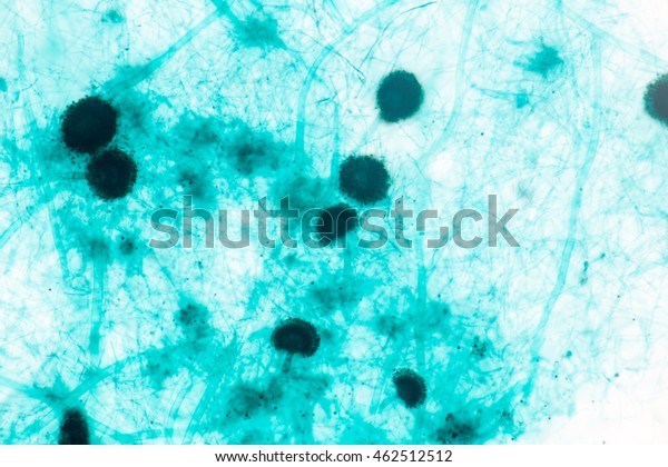Aspergillus Under Microscope View Stock Photo 462512512 | Shutterstock