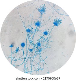 353 Aspergillus structure Images, Stock Photos & Vectors | Shutterstock