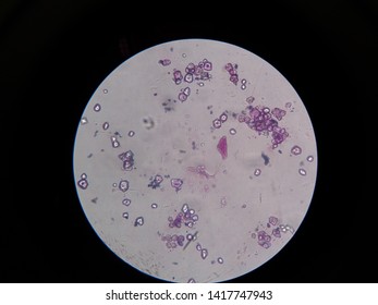 Nocardia Sputum Modify Acid Fast Stainis库存照片1309806853 | Shutterstock