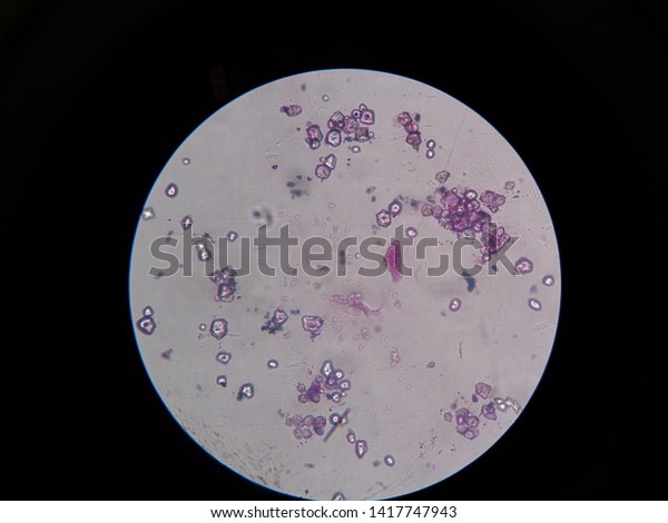 Assorted Urinary Crystals Under Microscope View Stock Photo 1417747943 ...