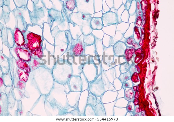 Background Bordered Pit Cell Under Microscope Stock Photo (Edit Now ...