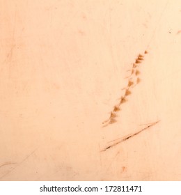 Long Scar Staples Fasteners Clamp On Stock Photo (Edit Now) 574509778