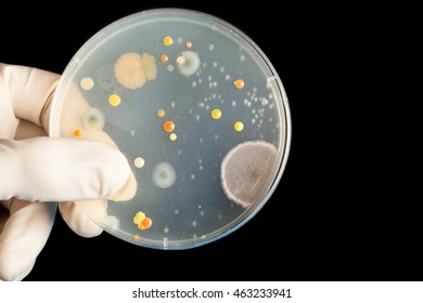Individual Colonies Saccharomyces Cerevisiae Yeast Growing Stock Photo ...