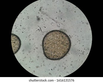 Bacteria Bread Under Microscope Stock Photo 1616131576 | Shutterstock