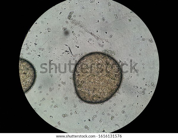 Bacteria Bread Under Microscope Stock Photo 1616131576 | Shutterstock