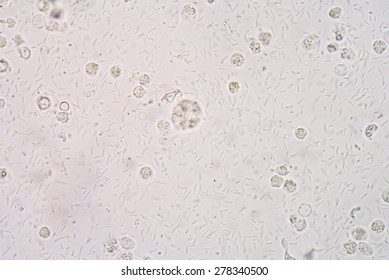 Crystal Liked Needle Intracellular Fibrin Stock Photo 1207560055 ...