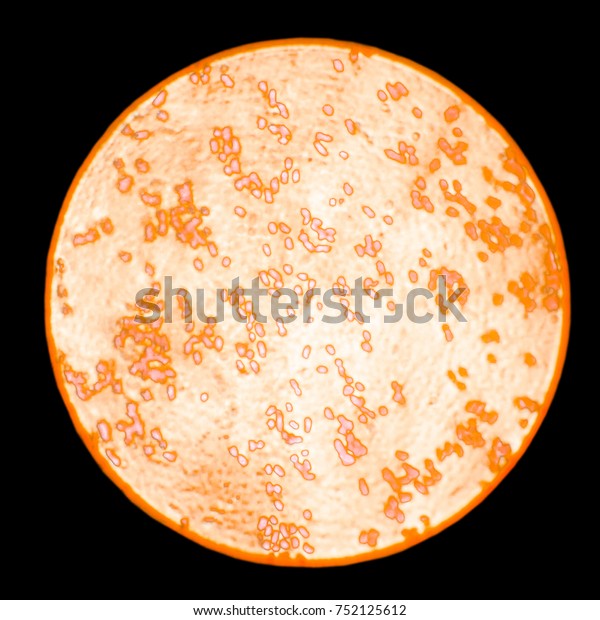 Bacteria Microorganism Under Microscope Macro Stock Photo 752125612 ...