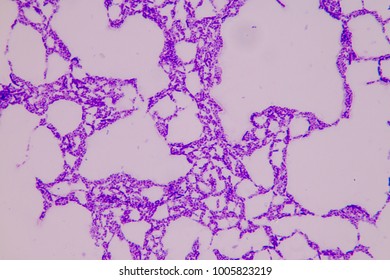 Bacteria On Slide Under Microscope Constitute Stock Photo 1005823219 ...