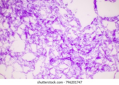 33 Spirillum microscope slide Gambar, Foto Stok & Vektor | Shutterstock