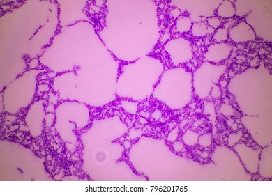 Bacteria On Slide Under Microscope Constitute Foto Stok 1005823240 ...