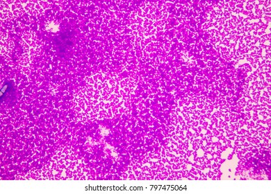 Bacteria On Slide Under Microscope Constitute Stock Photo 797475064 ...