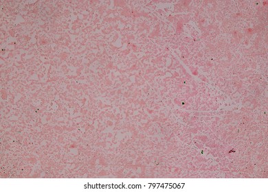 33 Spirillum microscope slide Gambar, Foto Stok & Vektor | Shutterstock