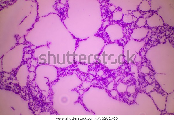Bacteria On Slide Under Microscope Constitute 스톡 사진(지금 편집) 796201765