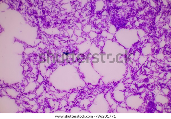 Bacteria On Slide Under Microscope Constitute Stock Photo 796201771 ...