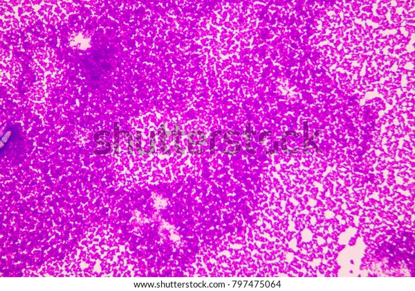 Bacteria On Slide Under Microscope Constitute Stock Photo 797475064 ...