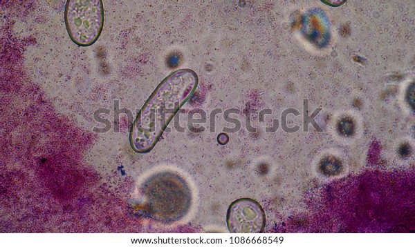 Bacteria Under Microscope 100x Stock Photo (Edit Now) 1086668549