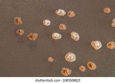 Bacterial Colonies Different Morphologies Stock Photo 1083508823 ...