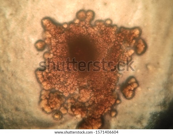 Bacterial Colonies Under Microscope Stock Photo 1571406604 | Shutterstock