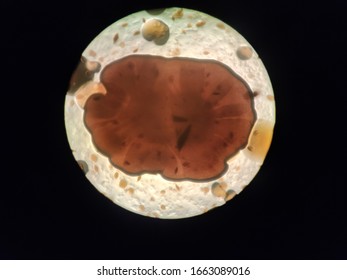 Bacterial Colony Under Microscope Stock Photo 1663089016 | Shutterstock