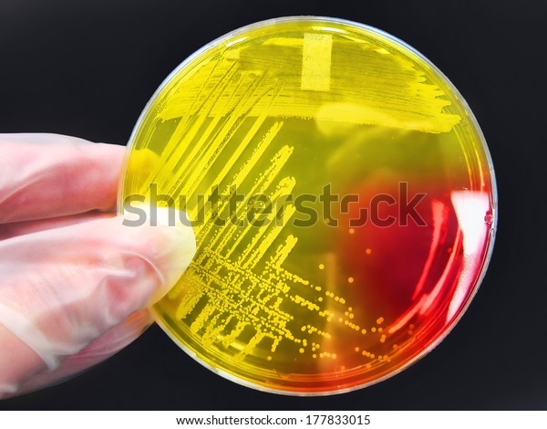 Bacterial Pathogen Staphylococcus S Aureus Colony Stock Photo (Edit Now ...