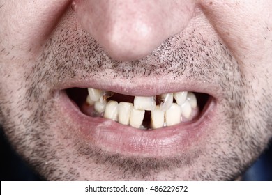 Toothless Man Smiling Toothless Man Her Stock Photo 1349334548 ...