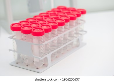 Batch Laboratory Plastic Test Tubes Lab Stock Photo 1906230637 ...