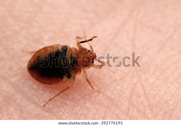Bed Bug Cimex Lectularius On Human Stock Photo 392776195 | Shutterstock