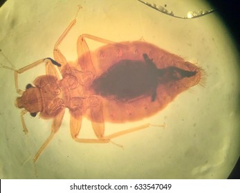1,903 Bed Bug Close Up Images, Stock Photos & Vectors | Shutterstock