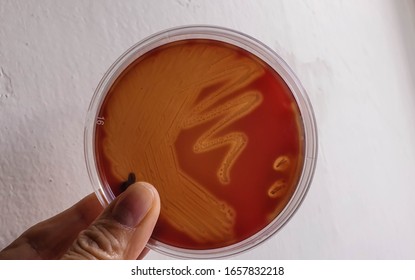 Patrón de hemólisis beta de Streptococcus: foto de stock (editar ahora ...