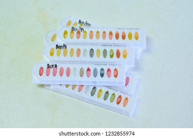 Biochemical Test Identification Bacteria Using Various Stock Photo ...