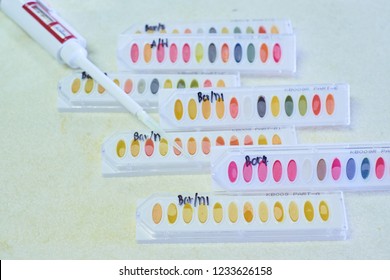 Biochemical Test Identification Bacteria Using Various Stock Photo ...