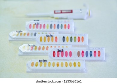 Biochemical Test Identification Bacteria Using Various Stock Photo ...