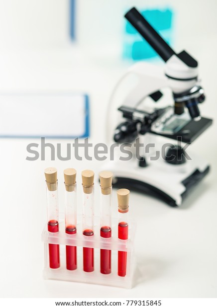 Biolab Microscope Tubes Samples Biomaterial Stock Photo 779315845 ...