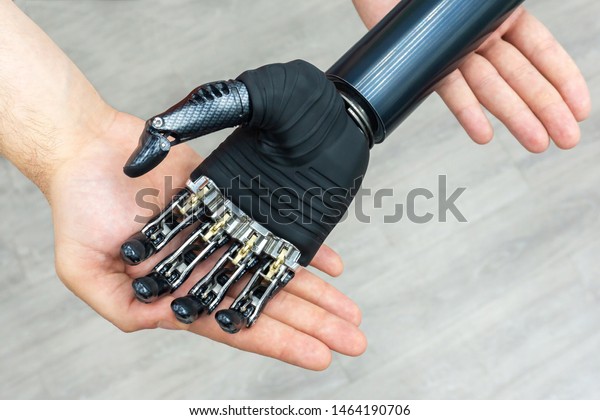 Bionic Hand Modern Technology Prosthetic Limbs Stock Photo 1464190706 ...