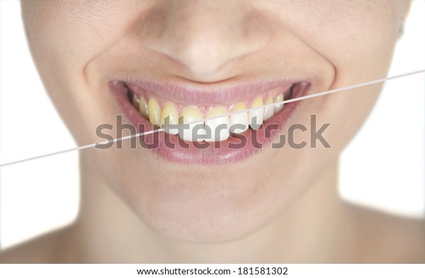 Bleaching Before After Stock Photo (Edit Now) 181581302